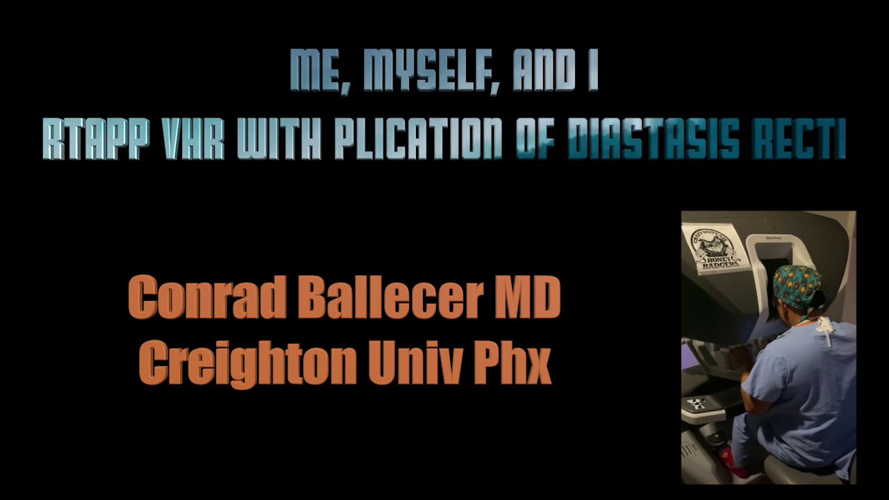 Me, Myself and I rTAPP VHR with plication of diastasis recti - YouTube