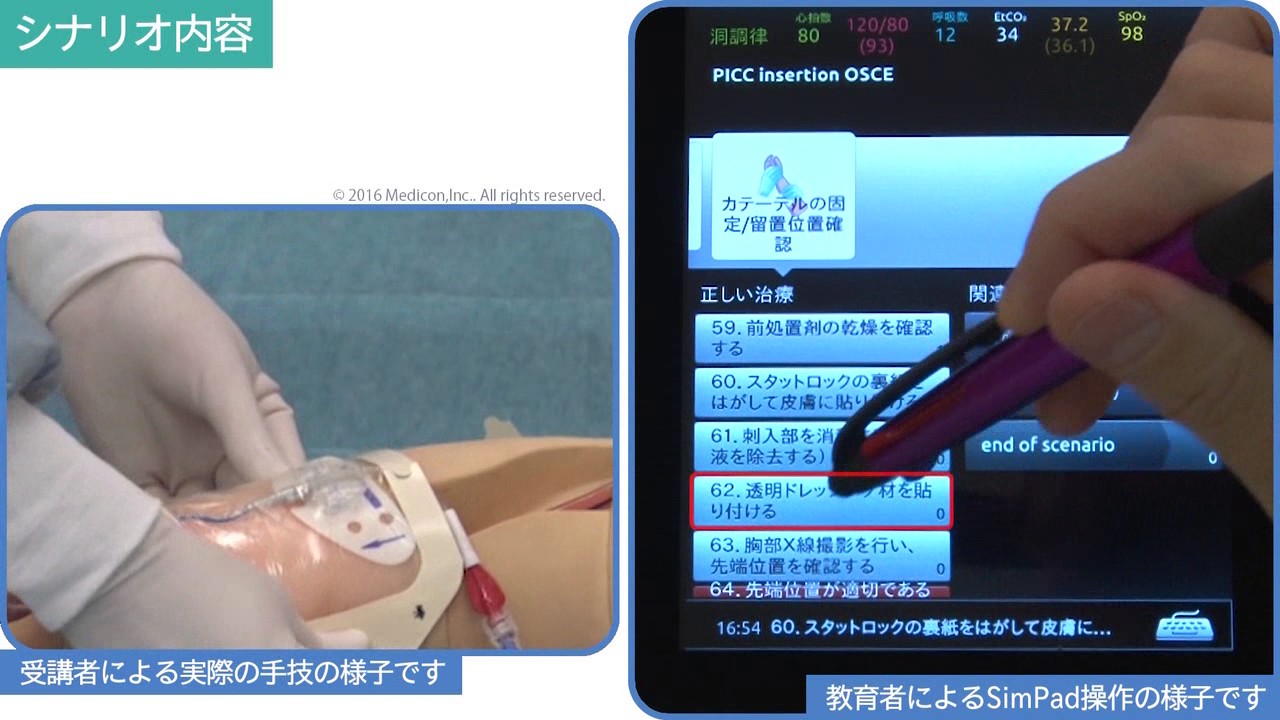 SimPad/SimPad PLUSを使った手技の評価 - YouTube