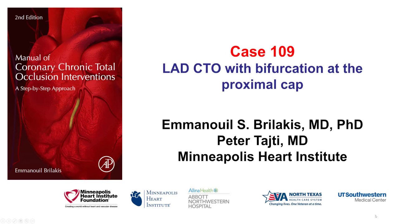 Case 109: Manual of CTO Interventions - LAD CTO with bifurcation at the ...