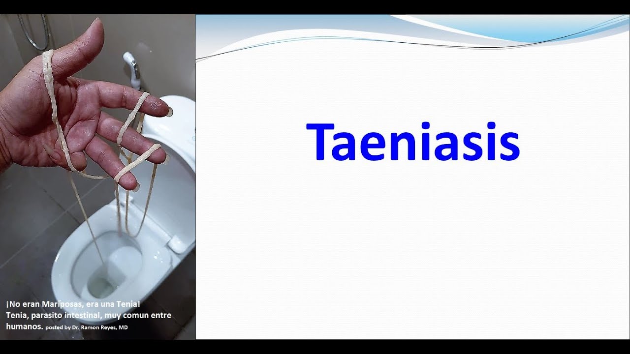 Taeniasis (T.saginata and T.solium) - YouTube