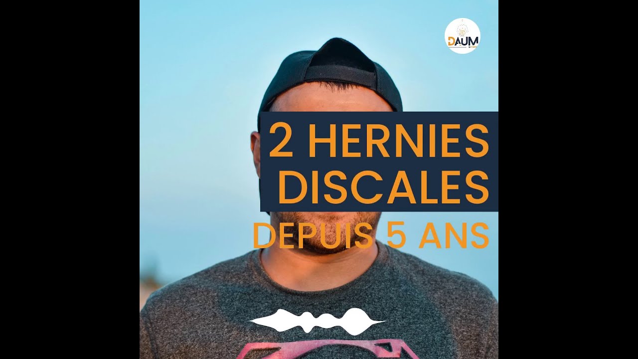 Corset Daum : Témoignage patient Mathieu Devos - YouTube