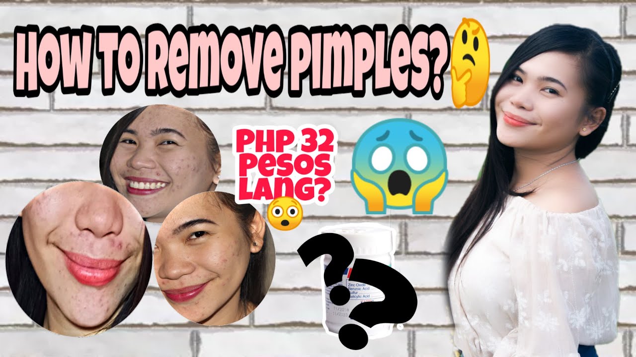 PAMPAWALA NG PIMPLES For only 32 pesos (Murang pampawala ng pimples ...