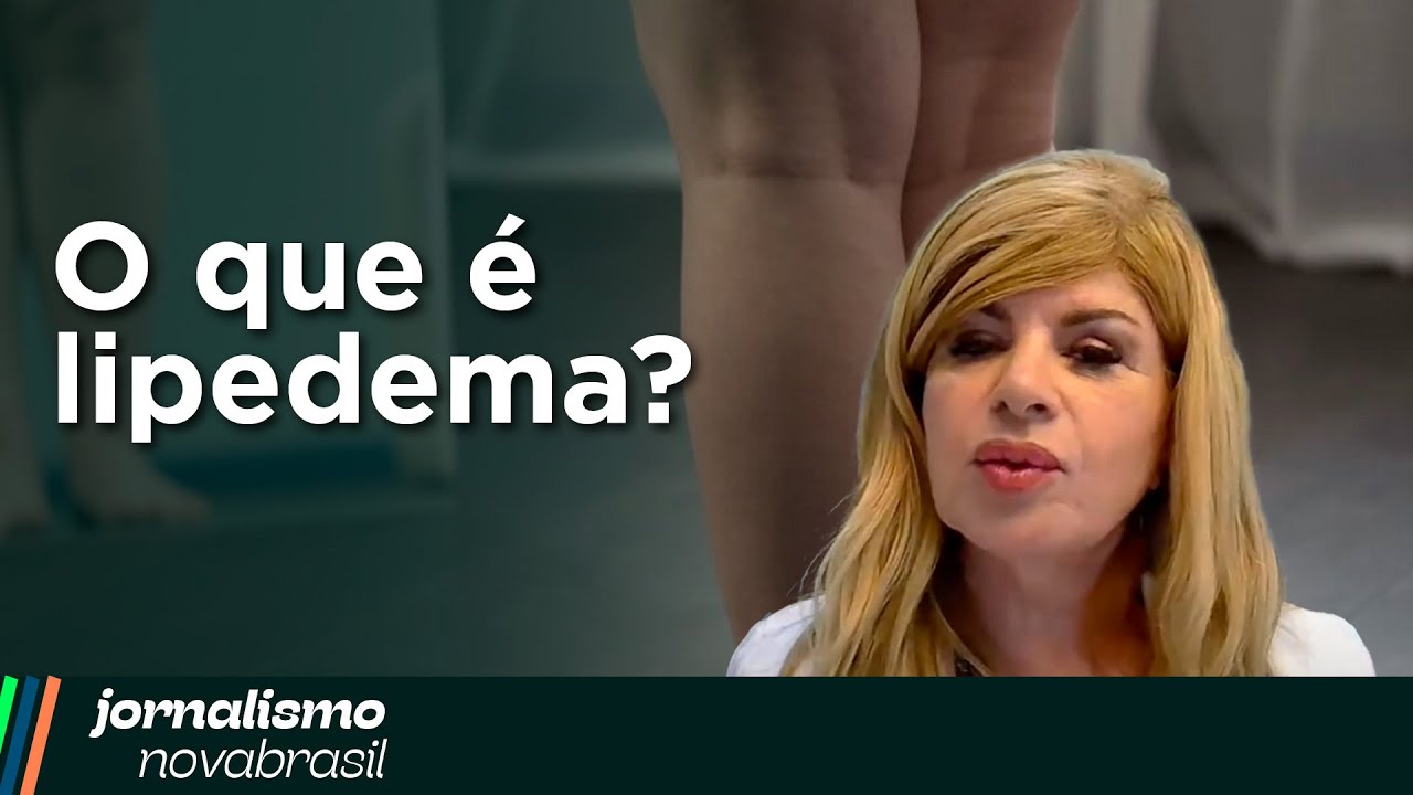 Lipedema: Especialista fala sobre os sintomas e tratamentos ...