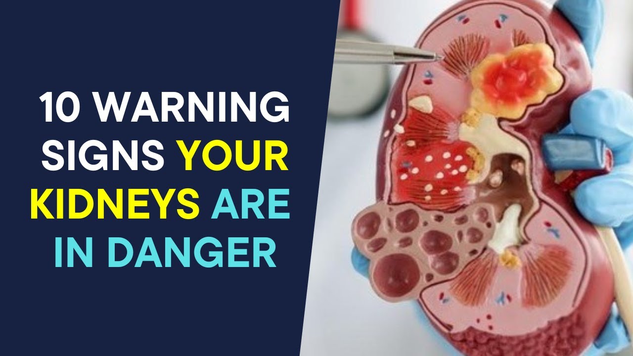 10 Warning Signs Your Kidneys are in Danger - YouTube