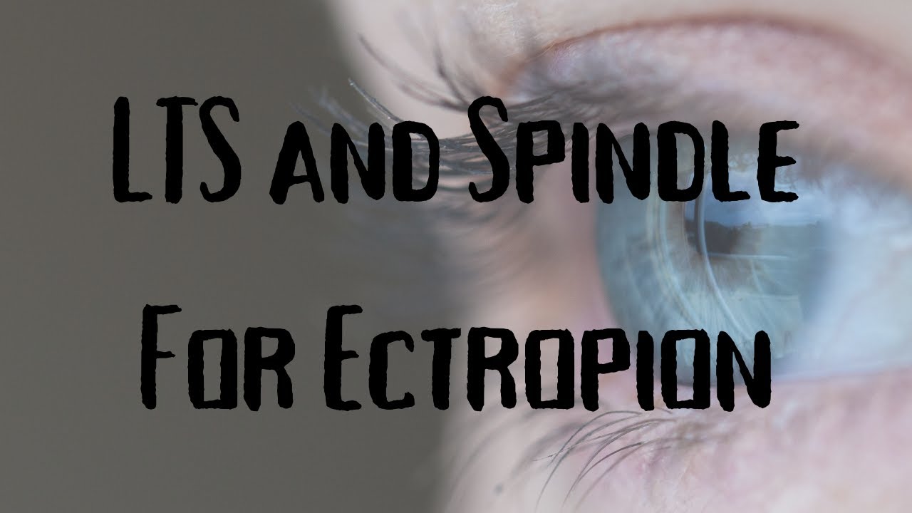 LTS and Spindle for Ectropion - YouTube
