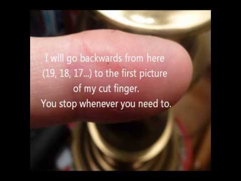 Time lapse - Watch my finger heal - YouTube