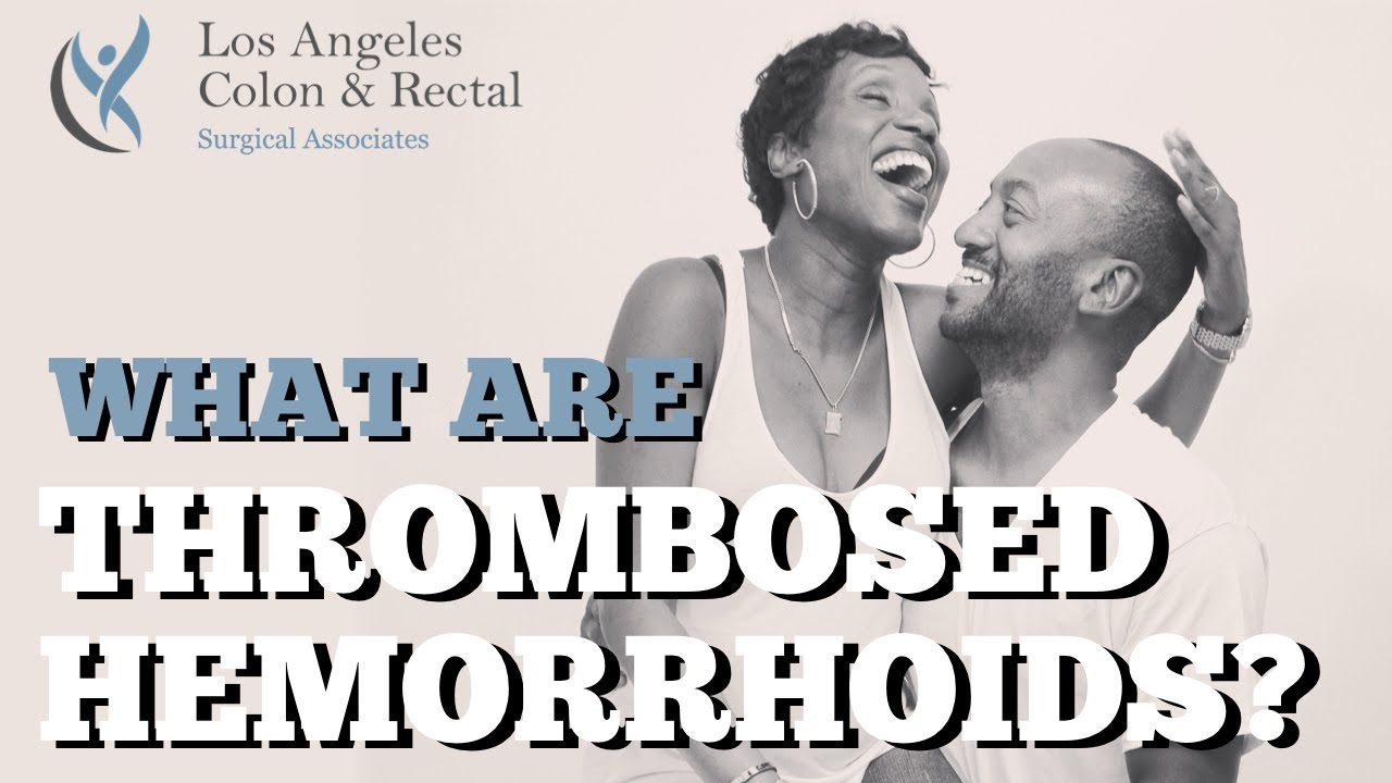 What Are Thrombosed Hemorrhoids YT - YouTube