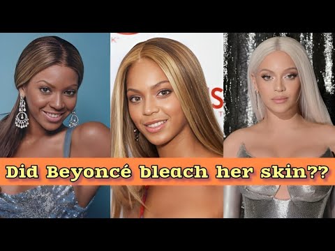 Beyoncé faces heavy BLEACHING accusations