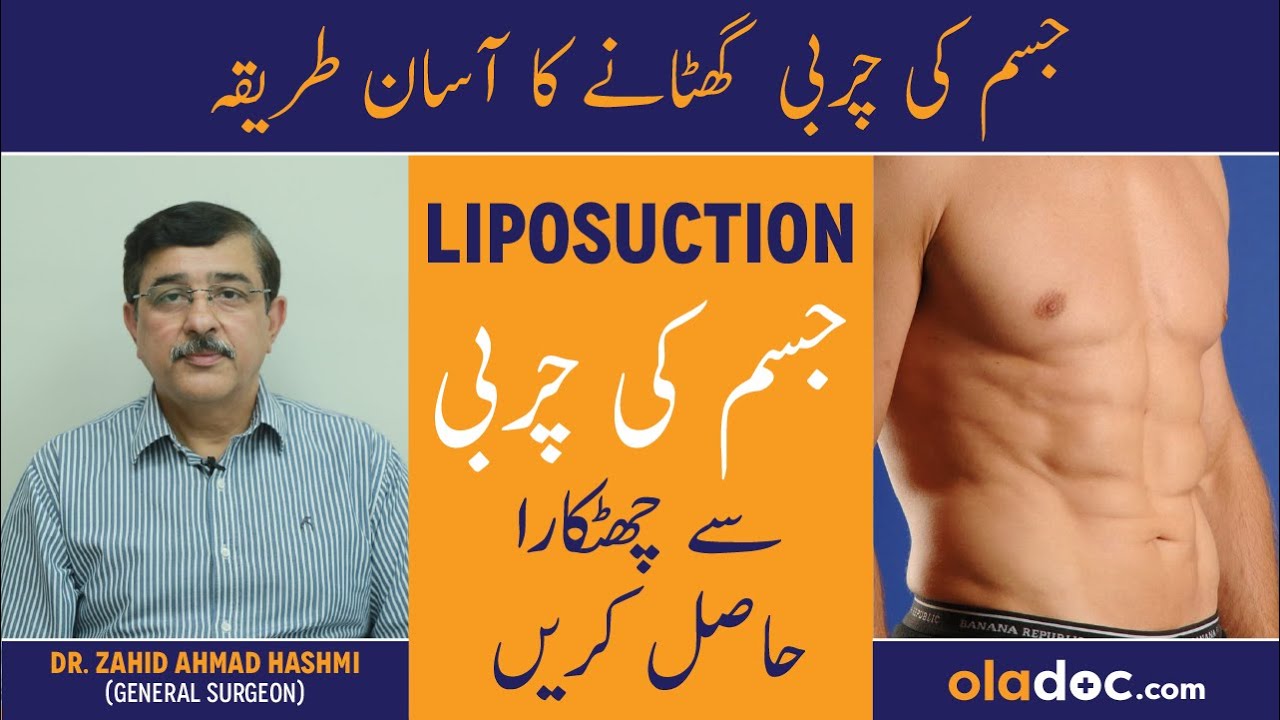 What You Need To Know About Liposuction - Best Way To Lose Fat ...