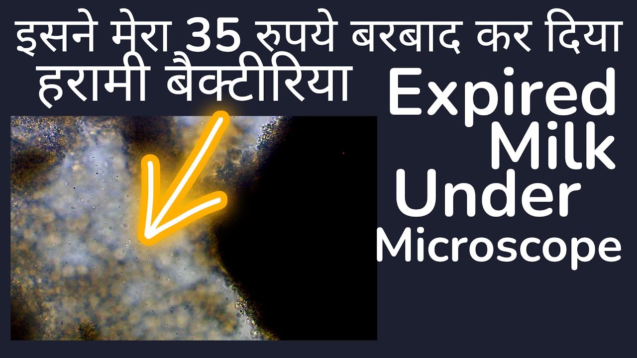 Milk under the microscope | expired milk under microscope | spoiled ...