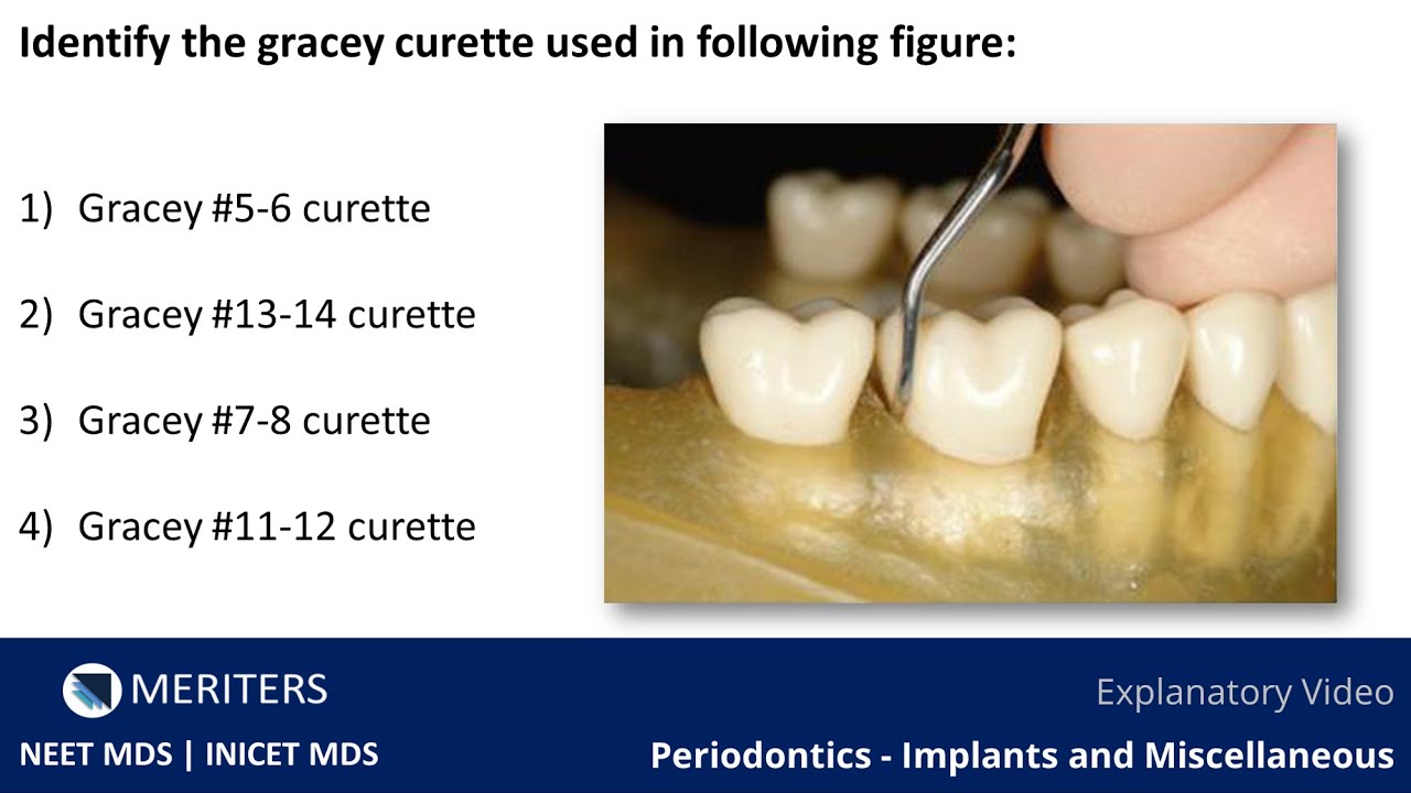 NEET MDS | INICET - Periodontics - Implants and Miscellaneous ...