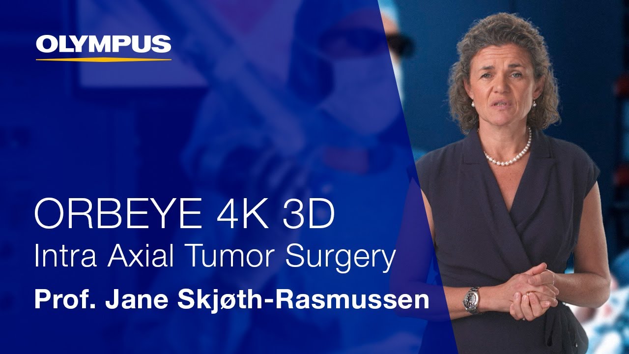 ORBEYE 4K 3D Intra Axial Tumor Surgery | Prof. Jane Skjøth-Rasmussen ...