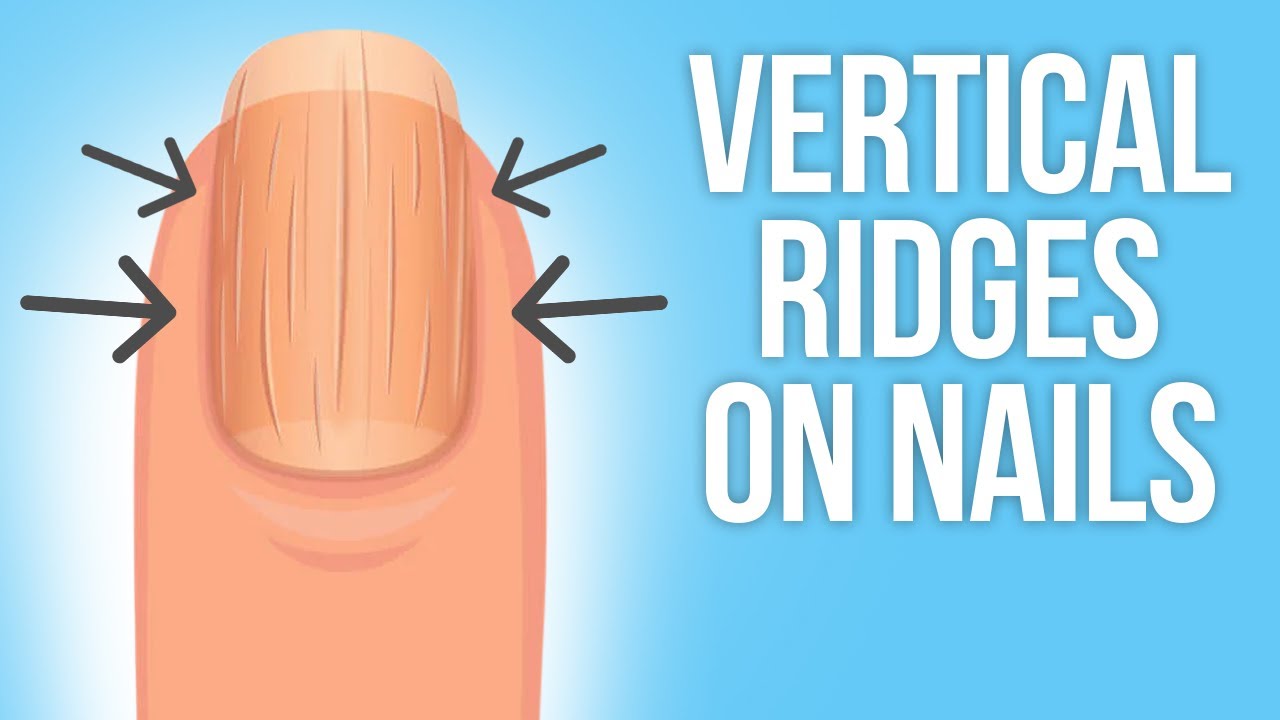 This Is WHAT Vertical Ridges on Your Nails REVEAL About Your Health ...