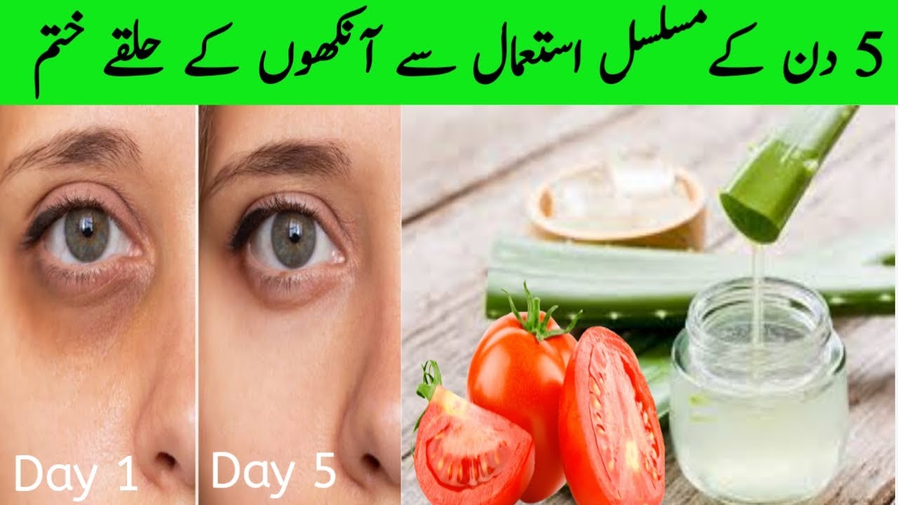 How to remove dark circles naturally in 5 days|Home remedies for dark ...