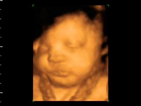 3D 4D Ultrasound baby scan. Window to the Womb Ltd - YouTube