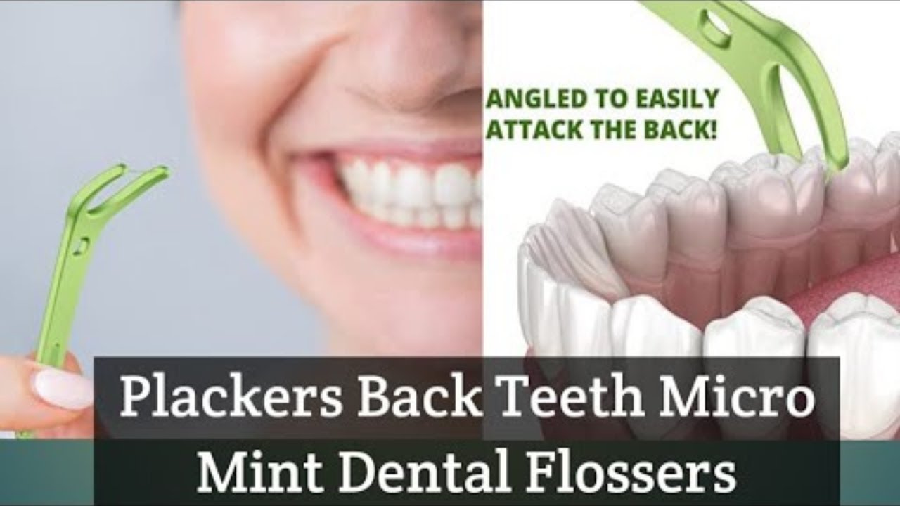 Plackers Back Teeth Micro Mint Dental Flossers, Provides Easy Access ...