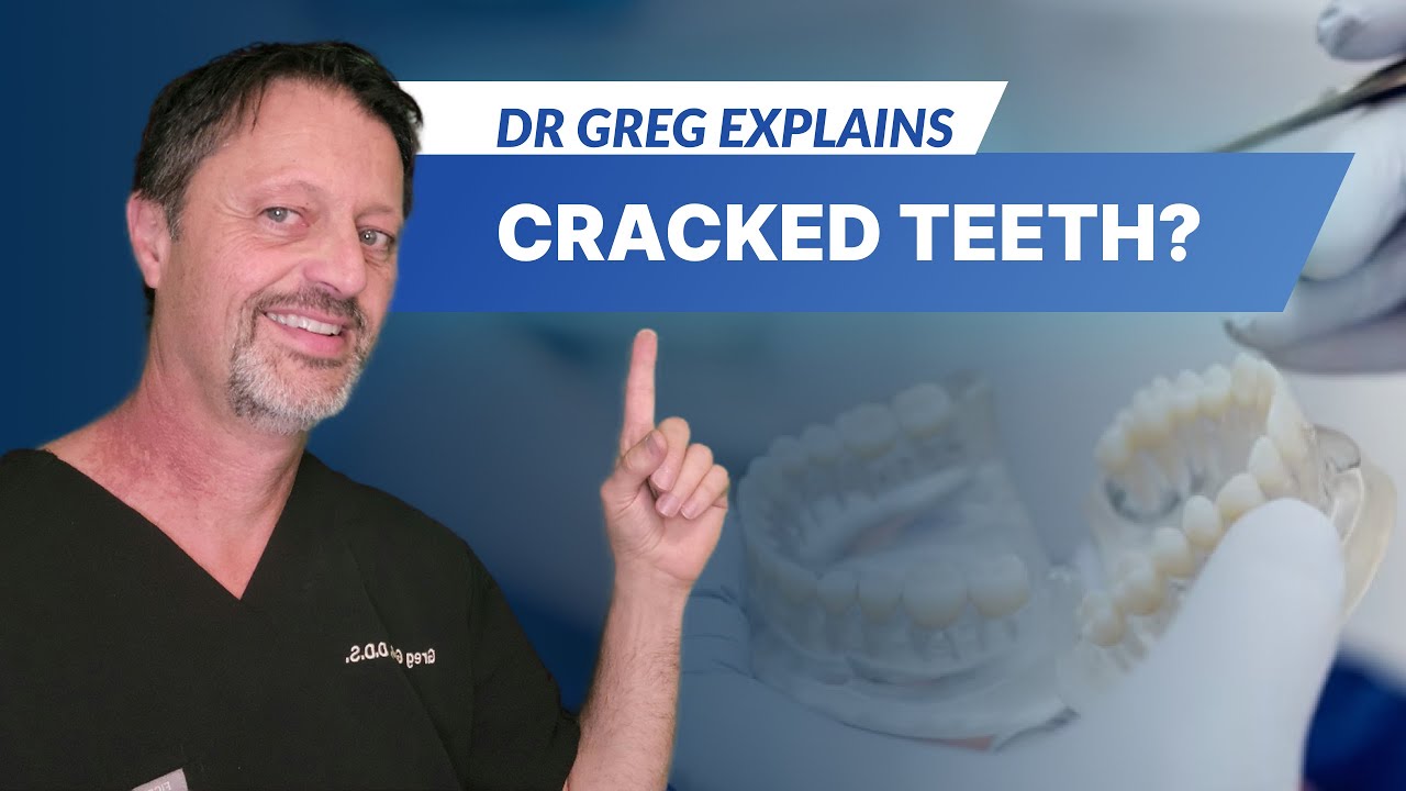 Cracked Teeth? Dr Greg Explains - YouTube