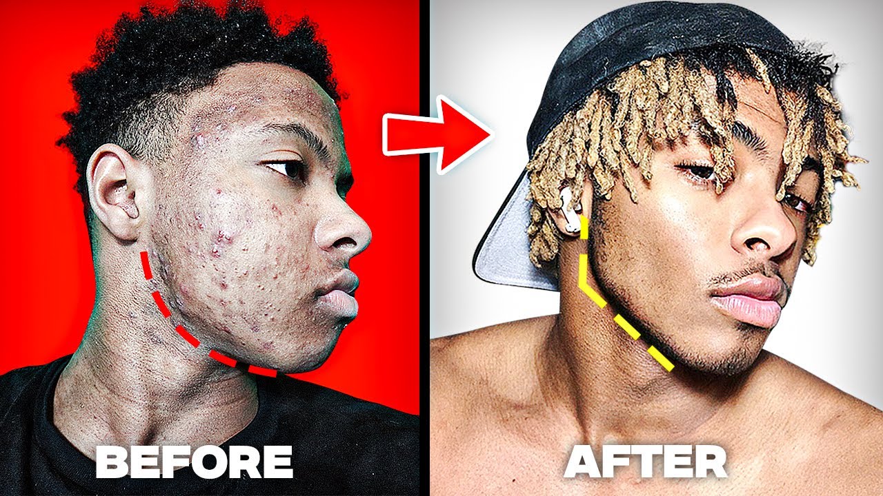 I Tried “Mewing” For 30 Days Straight - YouTube