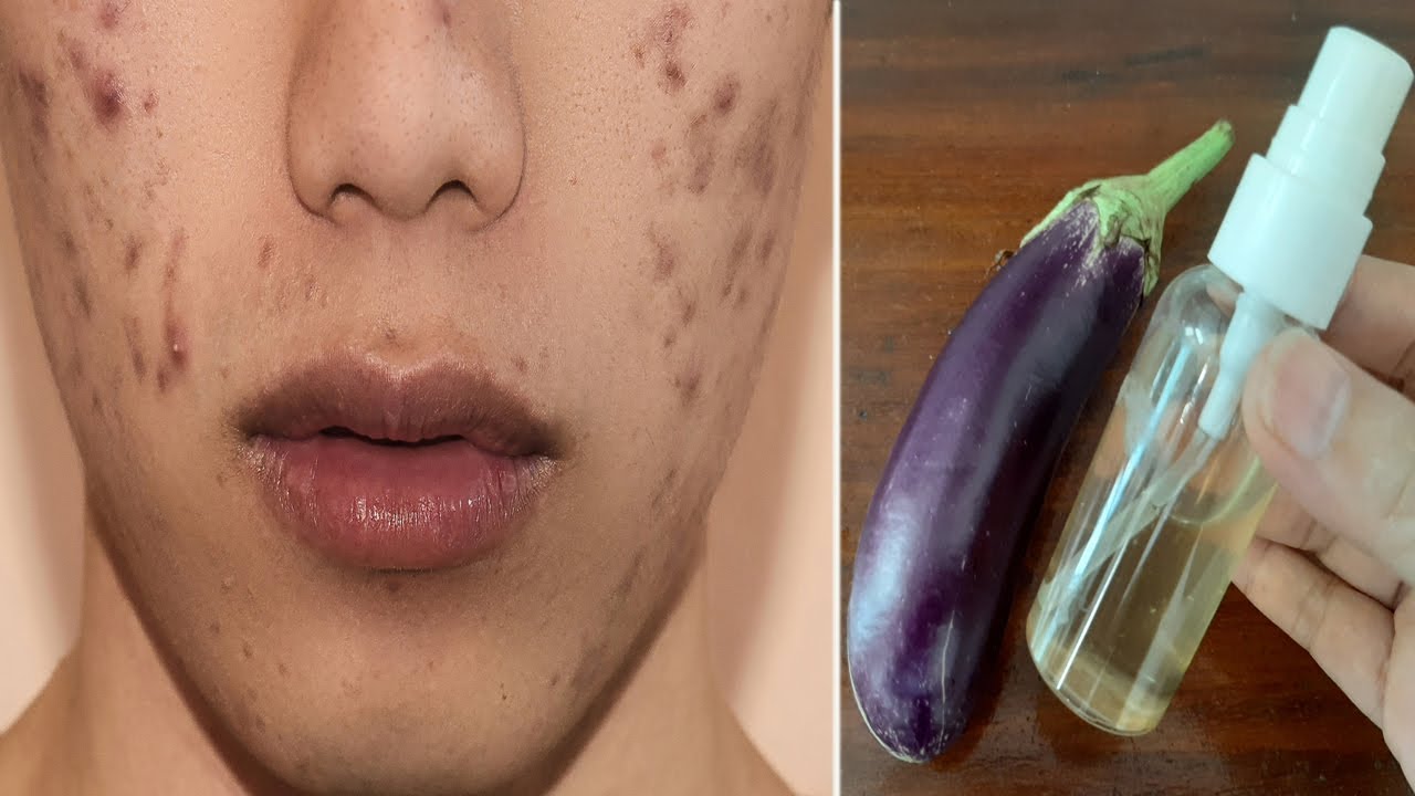 Remove Stubborn Spots and Wrinkles In 1 Week With Only 1 Material-cheap ...