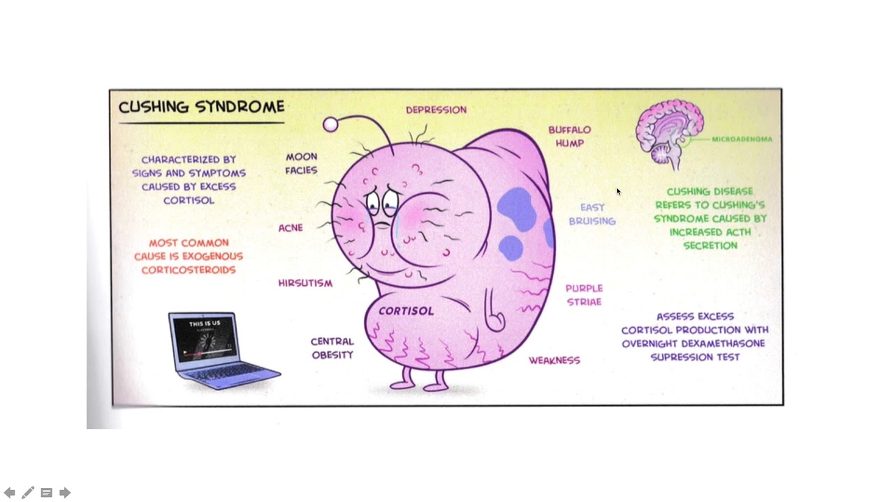 Algorithm 42 Cushings Syndrome Youtube