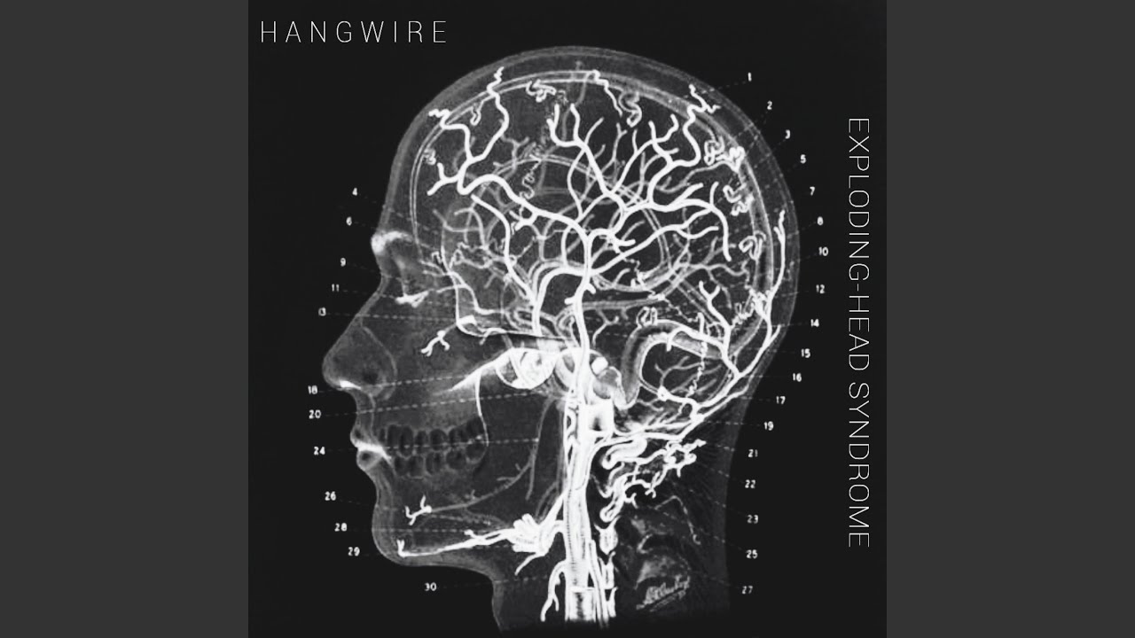 Exploding-Head Syndrome - YouTube Music