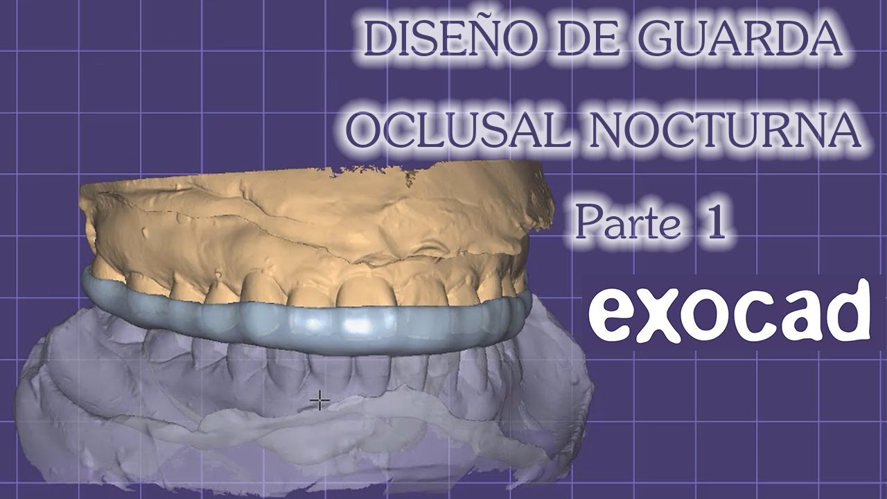 Diseño de Guarda Oclusal Nocturna | PARTE 1 - YouTube