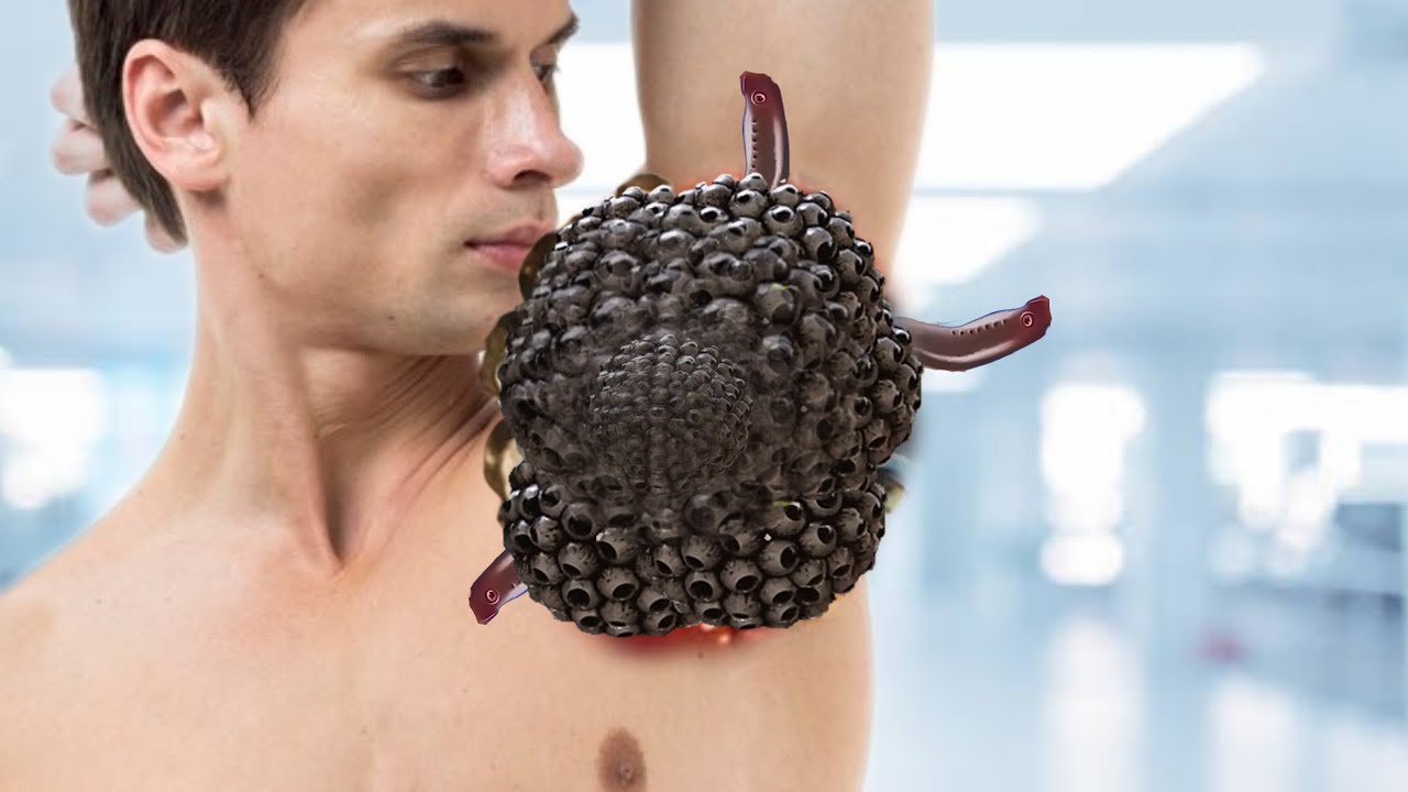 ASMR Animation TRYPOPHOBIA big incent treatment armpit | Asmr animation ...