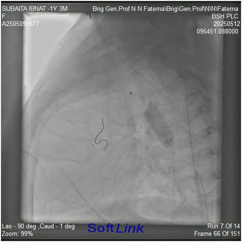 Subaita Ibnath 1 Y 3 M 7 Kg BAP for COA - YouTube