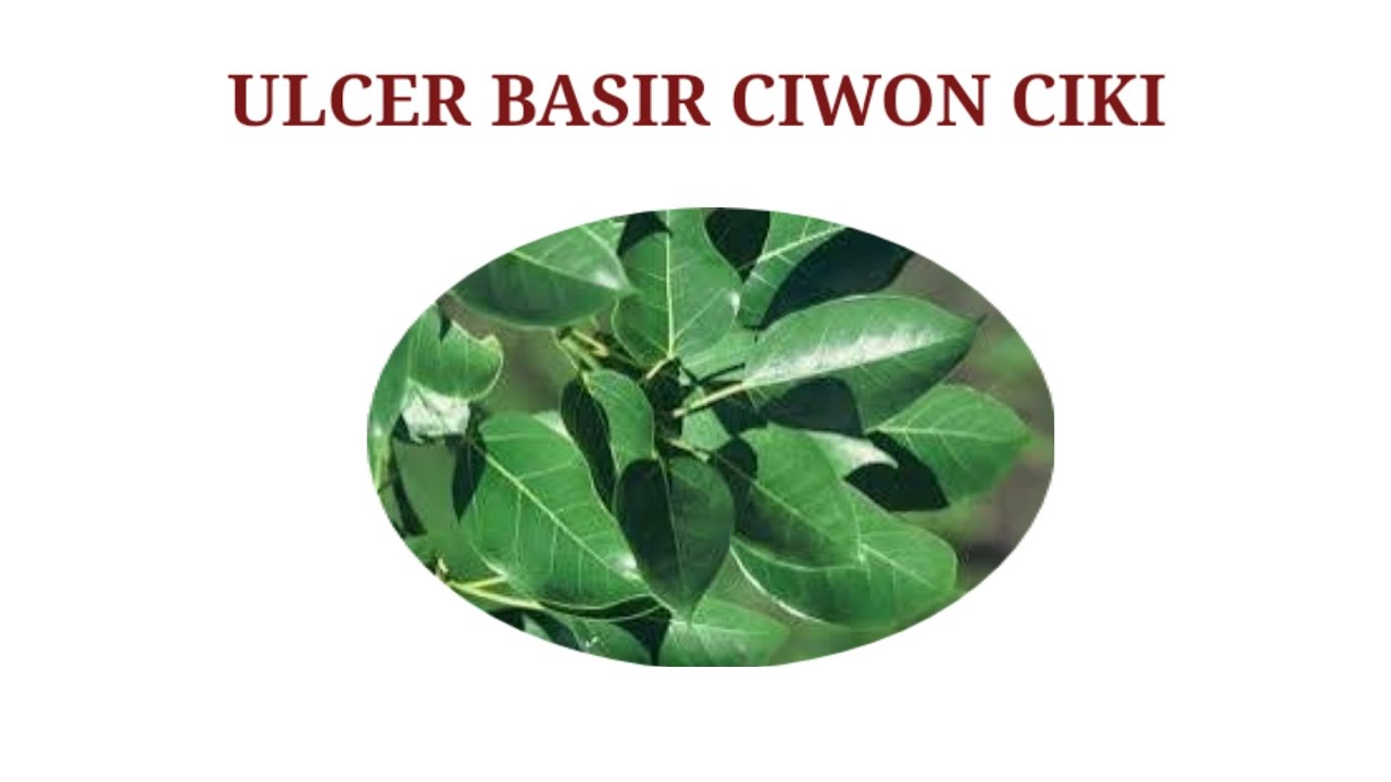 ULCER BASIR CIWON CIKI..#tilawatv #duet #unfrezzmyaccount - YouTube