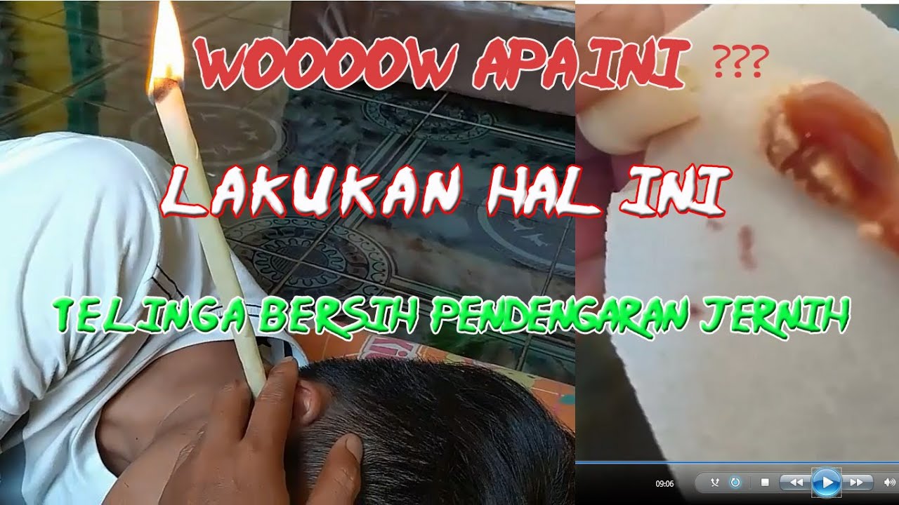 Cara Membersihkan Kotoran Telinga MENGGUNAKAN EAR CANDLE LILIN ...