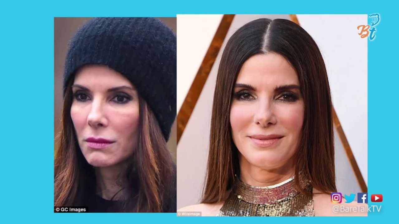 Sandra Bullock and Cheek Fillers? - YouTube