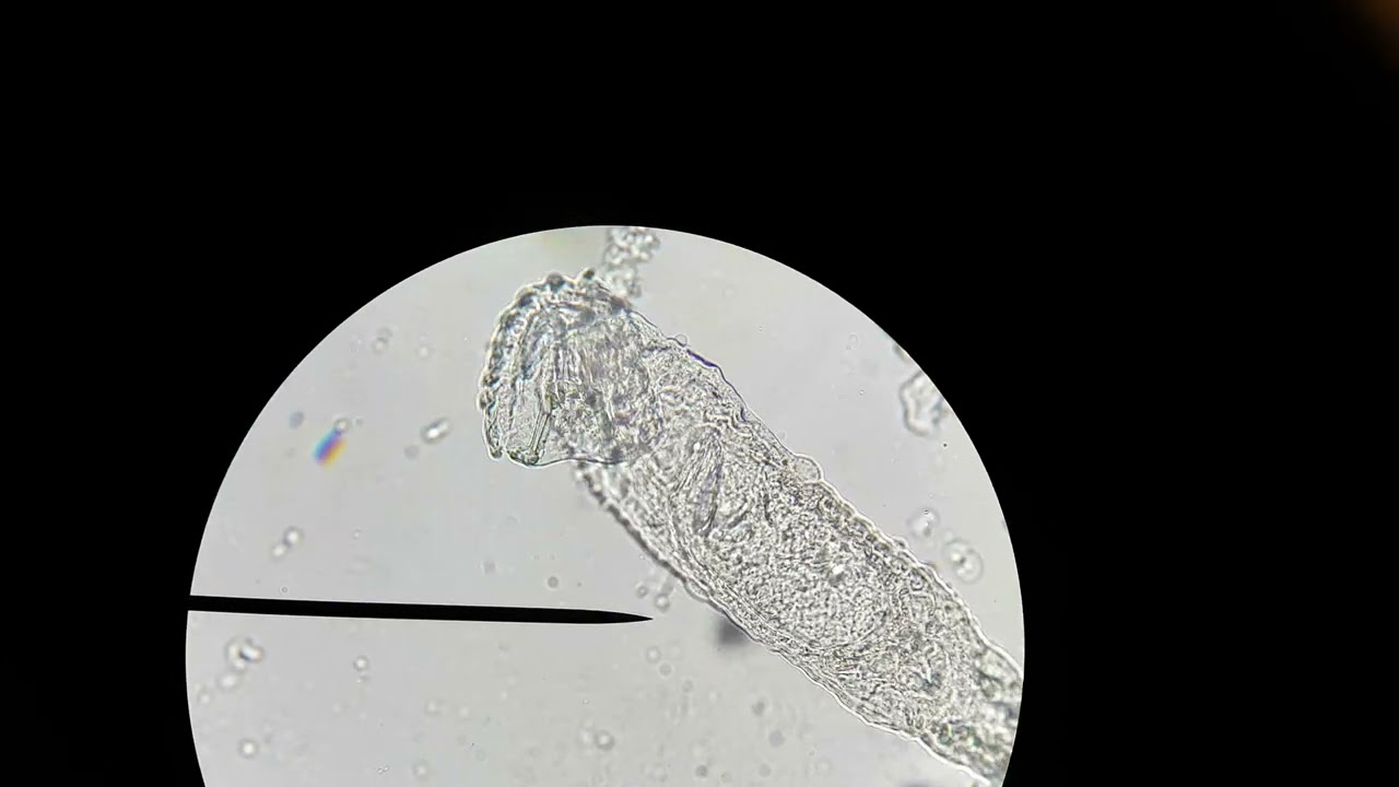 Skin Fluke Gyrodactylus - YouTube