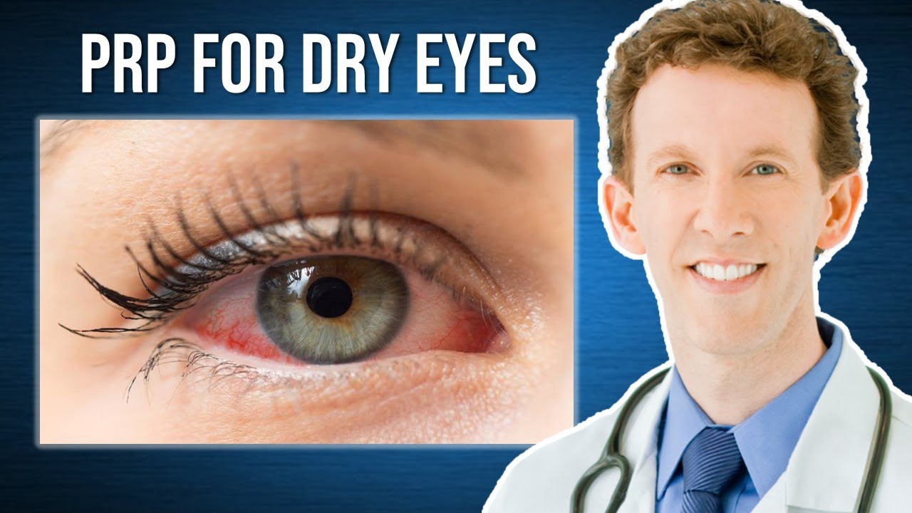 PRP Treatment for Dry Eyes with Dr. Scheiner | Carolyn's Testimonial ...