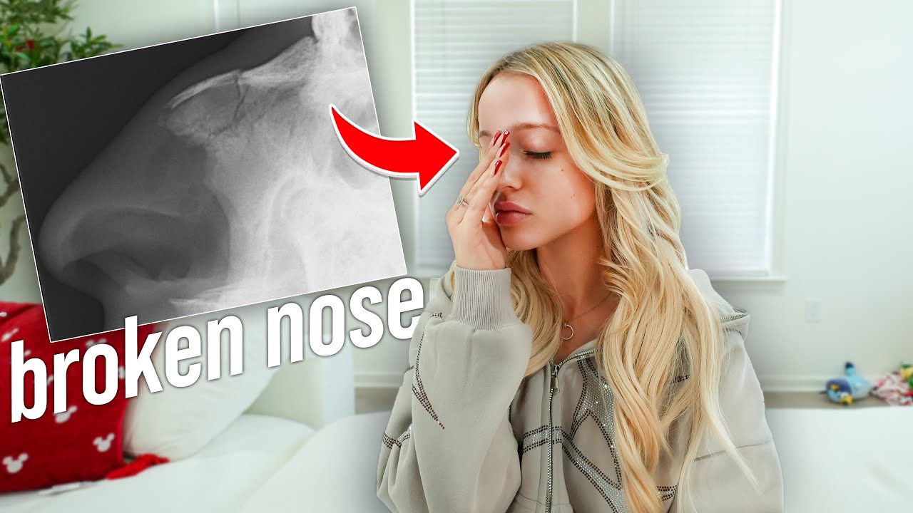TRICIA BROKE HER NOSE... *UH OH* - YouTube