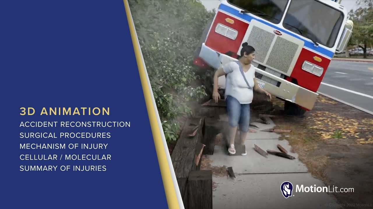 3D Animation of Woman Struck by a Waste Management Truck Shows Complete ...
