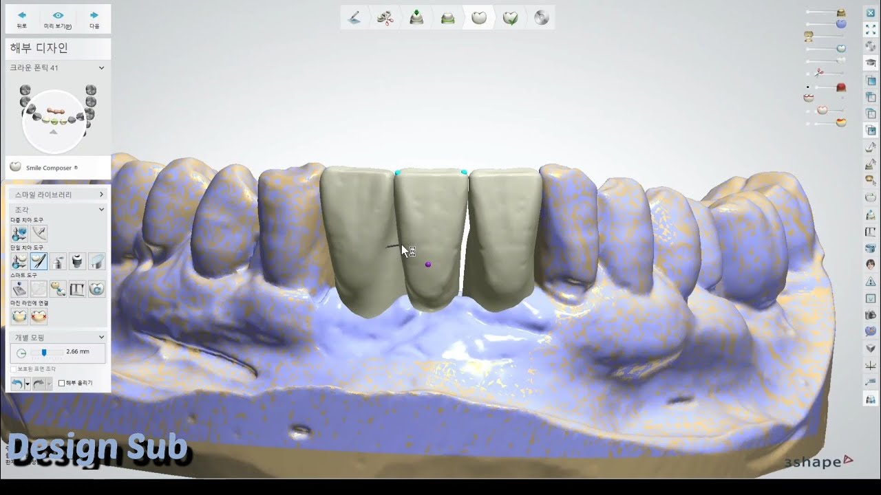 3shape design - YouTube