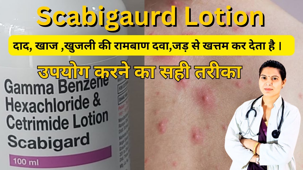 Scabigard Lotion Uses | Scabies Treatment In Hindi | दाद खाज खुजली की ...