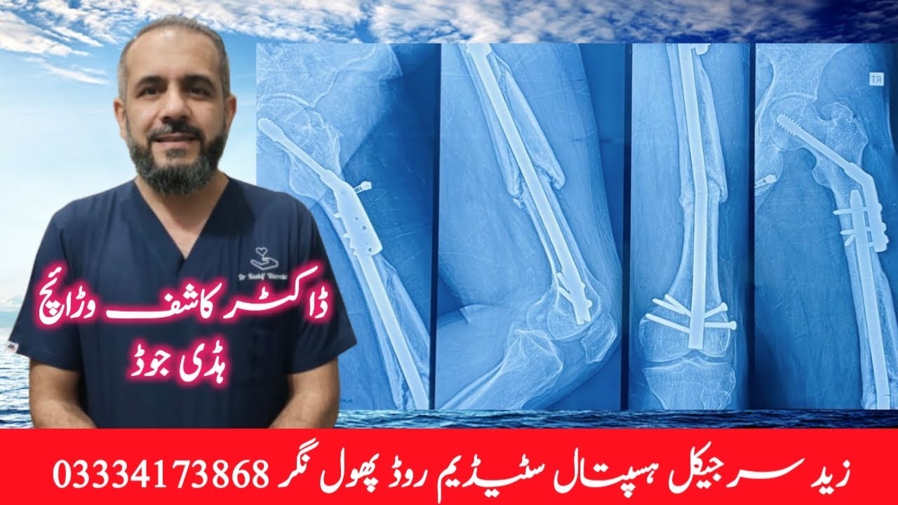 Zaid Surgical Hospital stadium road Phool Nagar - YouTube