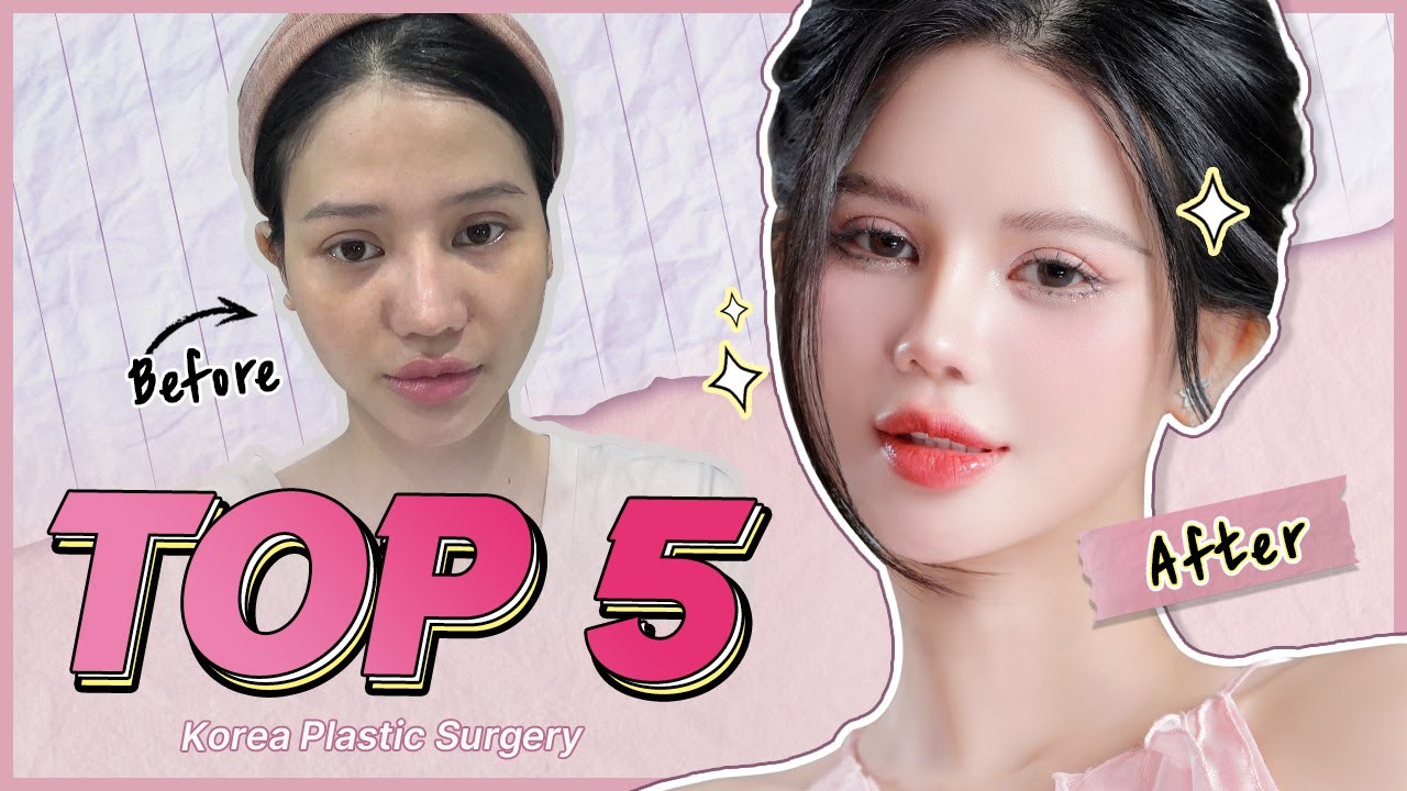 TOP5 Amazing Transformations/before and after | NANA HOSPITAL KOREA ...