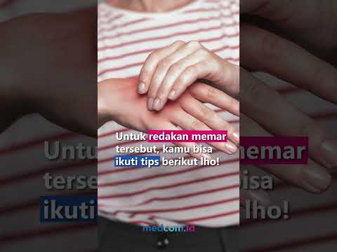 HARUS TAU! 3 PENGOBATAN ALAMI YANG MANJUR UNTUK MENGATASI MEMAR