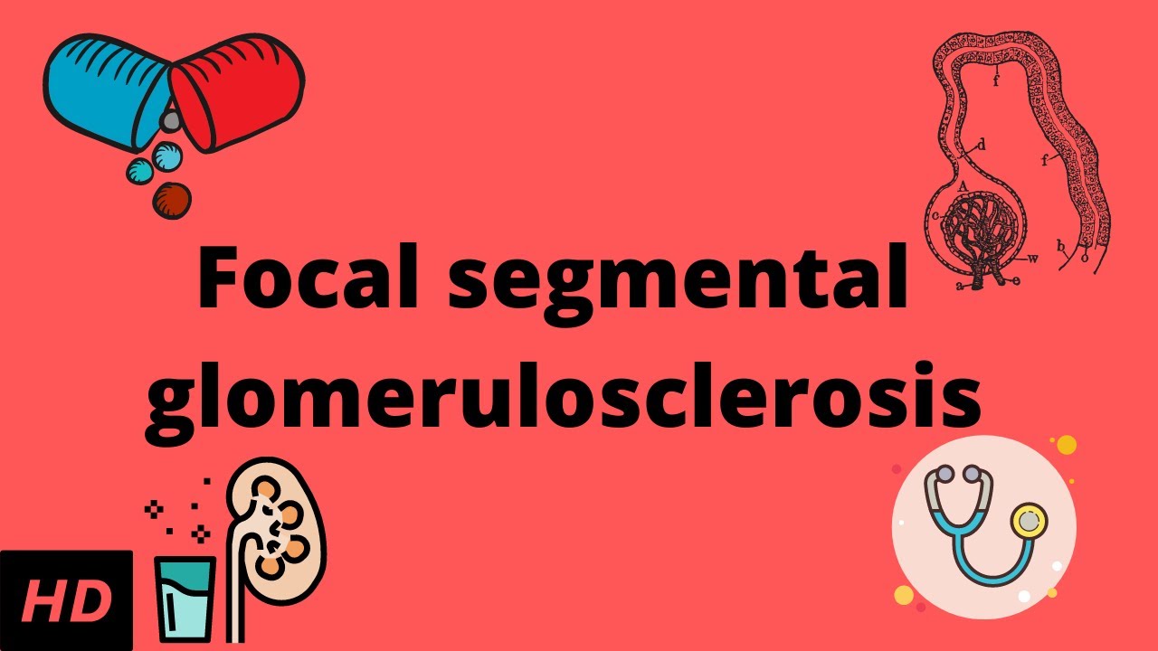 Focal Segmental Glomerulosclerosis, Causes, Signs and Symptoms ...