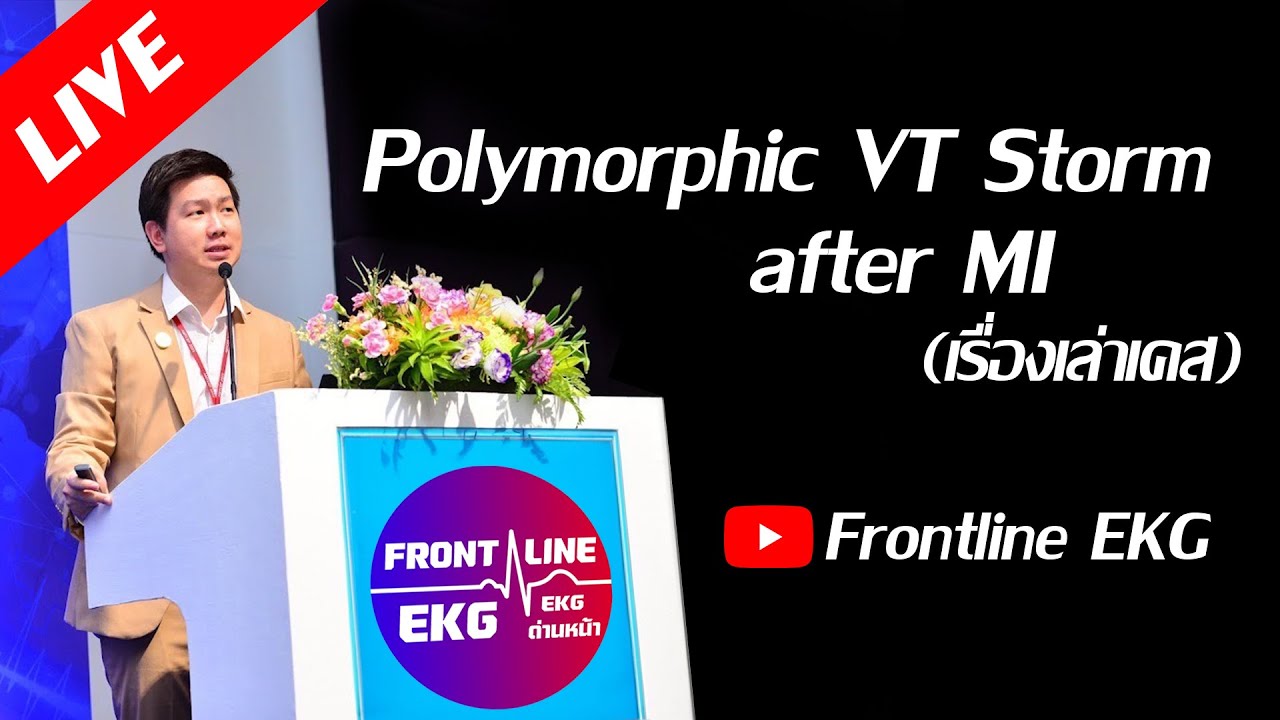 (Live) PCI ก็ทำแล้ว ทำไมยังมี PMVT Storm (Quinidine-Responsive PMVT in ...