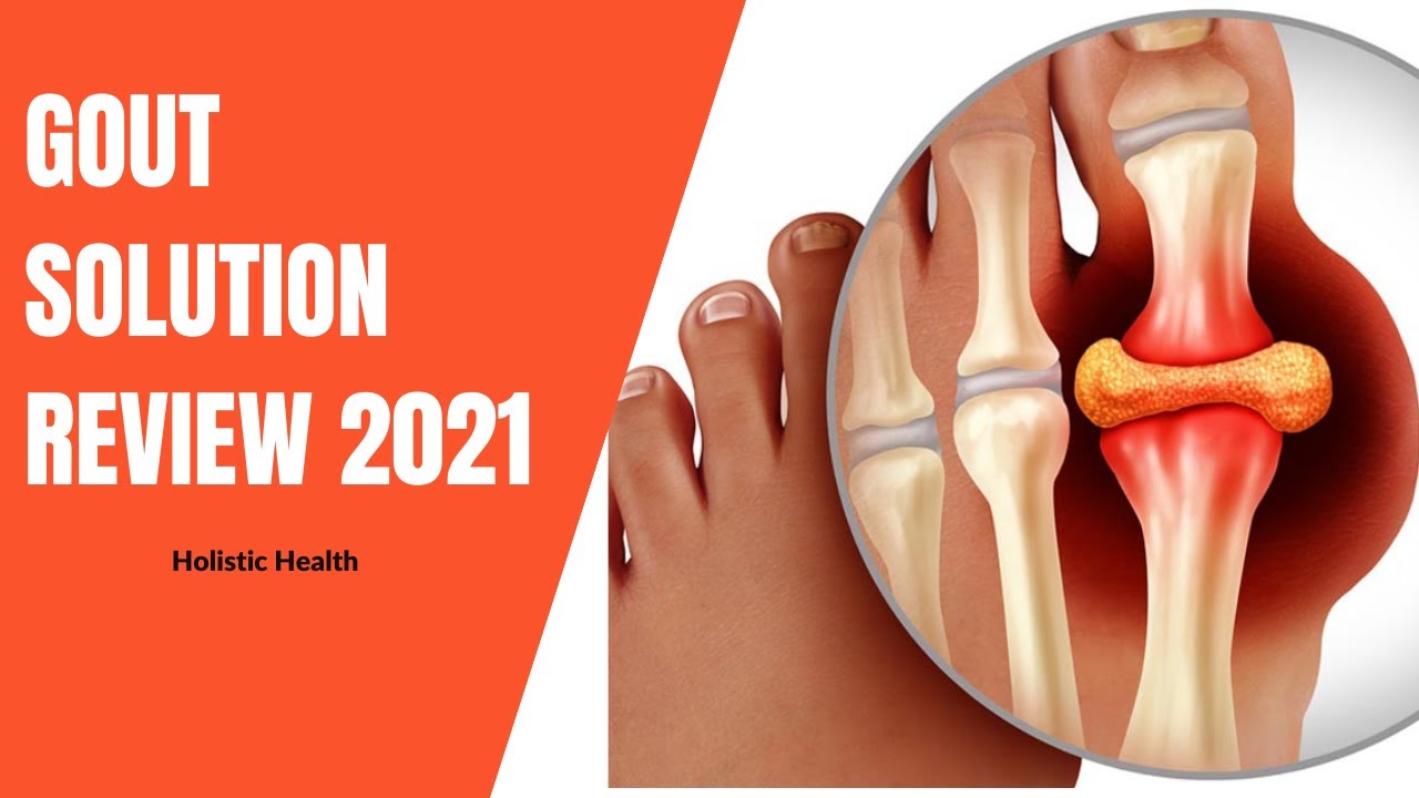 Gout Solution Review 2021 | Holistic Health - YouTube