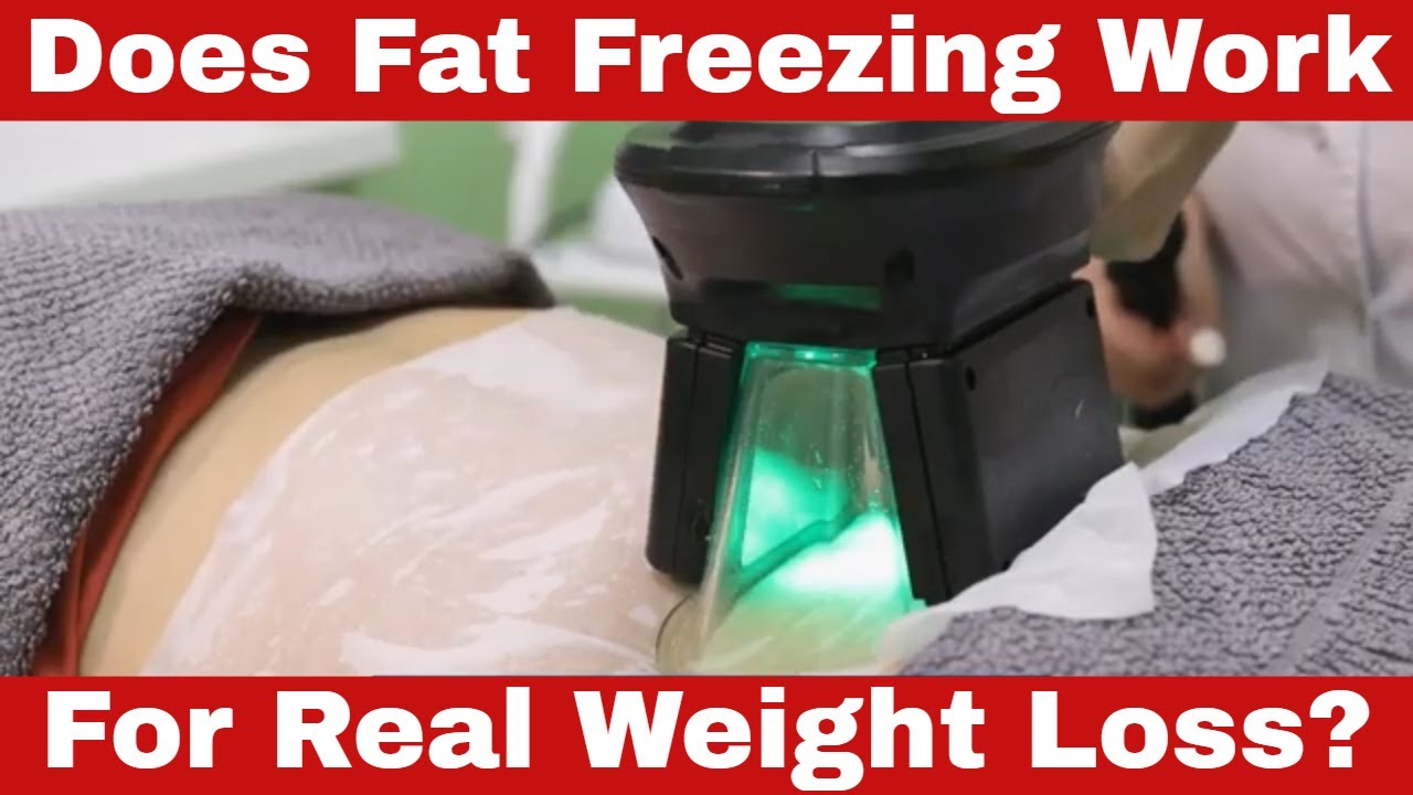 Does Fat Freezing Work? Freeze Your Fat Away? - YouTube
