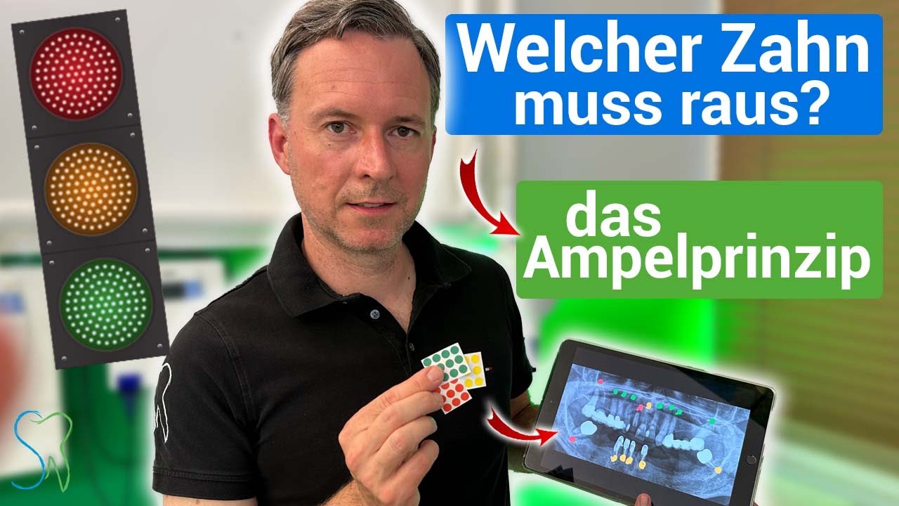 Zahnextraktion | Welche Zähne müssen raus? Das Ampelprinzip - YouTube
