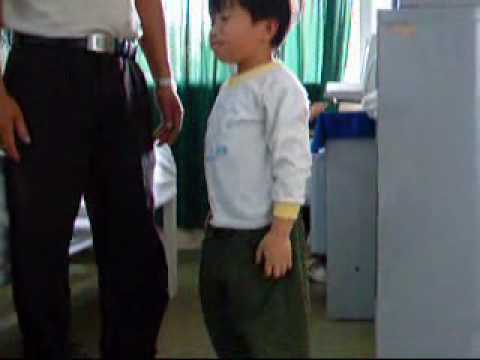GOWER SIGN(Duchenne muscular dystrophy).wmv - YouTube