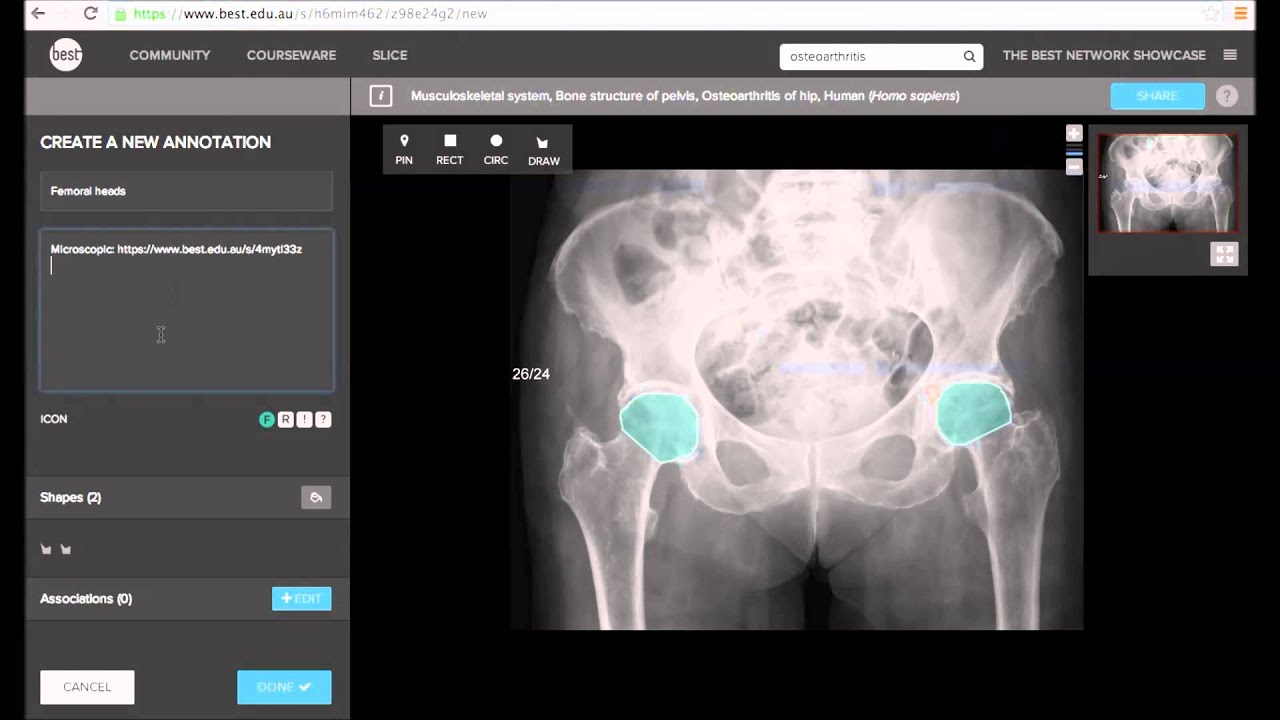 How to use Slice for students - YouTube