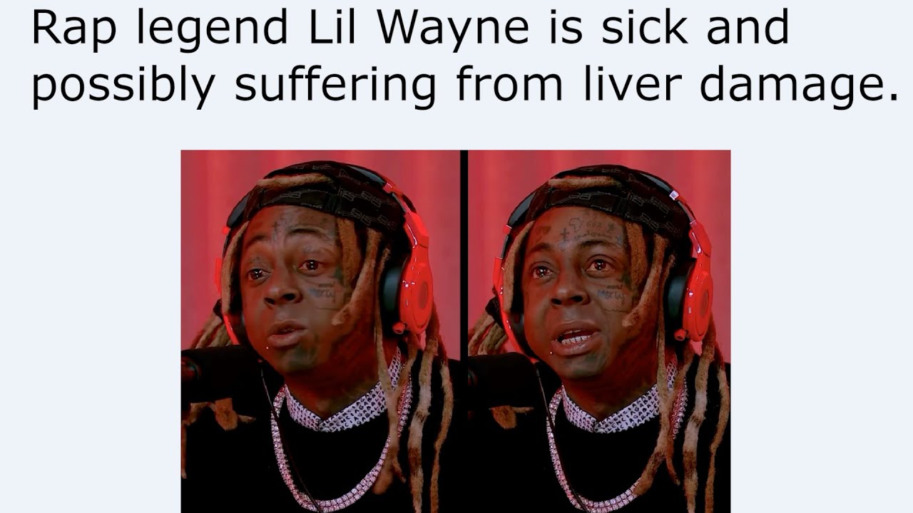 Rap legend Lil Wayne is sick and possibly suffering from liver damage ...