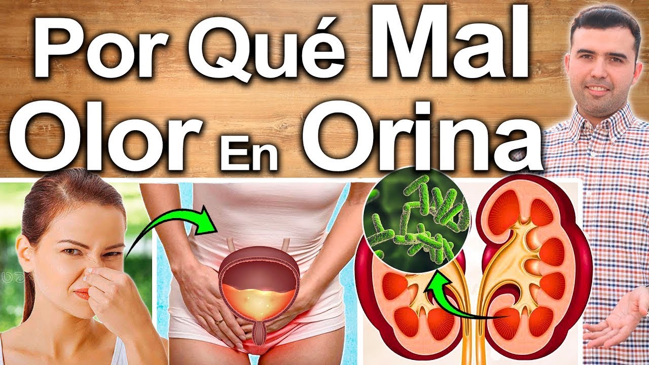 Porqué Tu Orina Huele Mal? - Causas Y Soluciones Para Eliminar El Mal ...