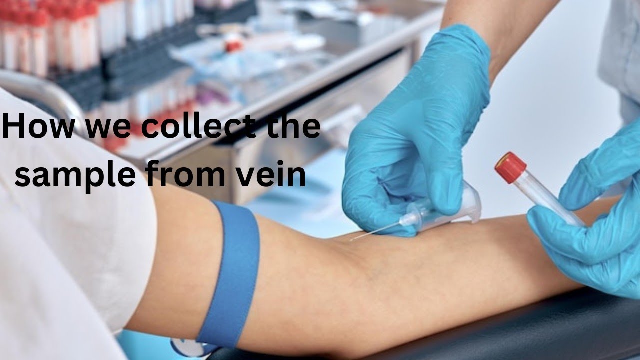 Step-by-Step Guide to Blood Collection from a Vein. Prepration ...